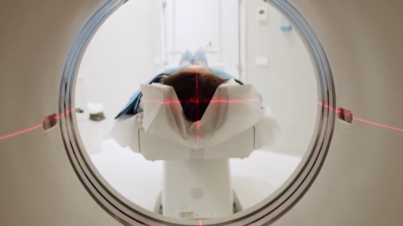 Community Medical Centers - Understanding traumatic brain injuries and ...